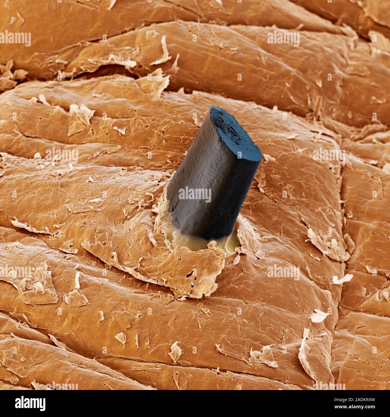 Hair stubble. Coloured scanning electron micrograph (SEM) of the cut ...