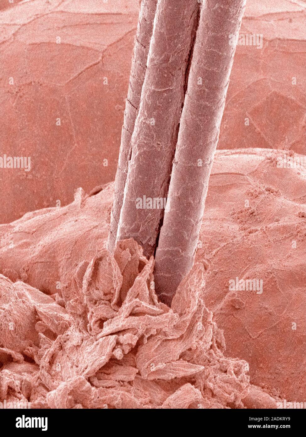 Human hair. Coloured scanning electron micrograph (SEM) of human hairs ...