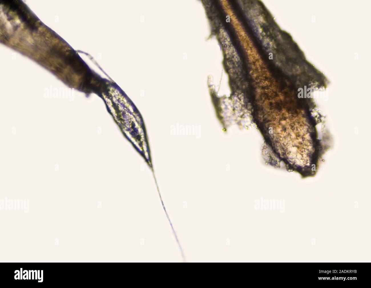 Live and dead hair follicle samples. Light micrograph showing the hair ...