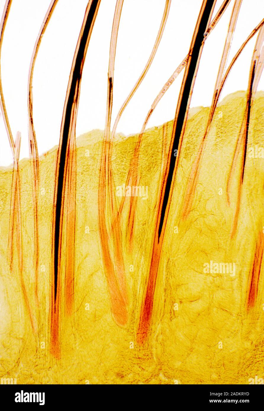 Hairs on the scalp. Coloured light micrograph showing the underlying ...
