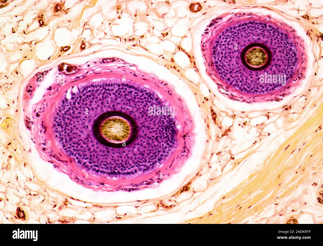 Hair follicles. Coloured light micrograph of a section through hairs of ...