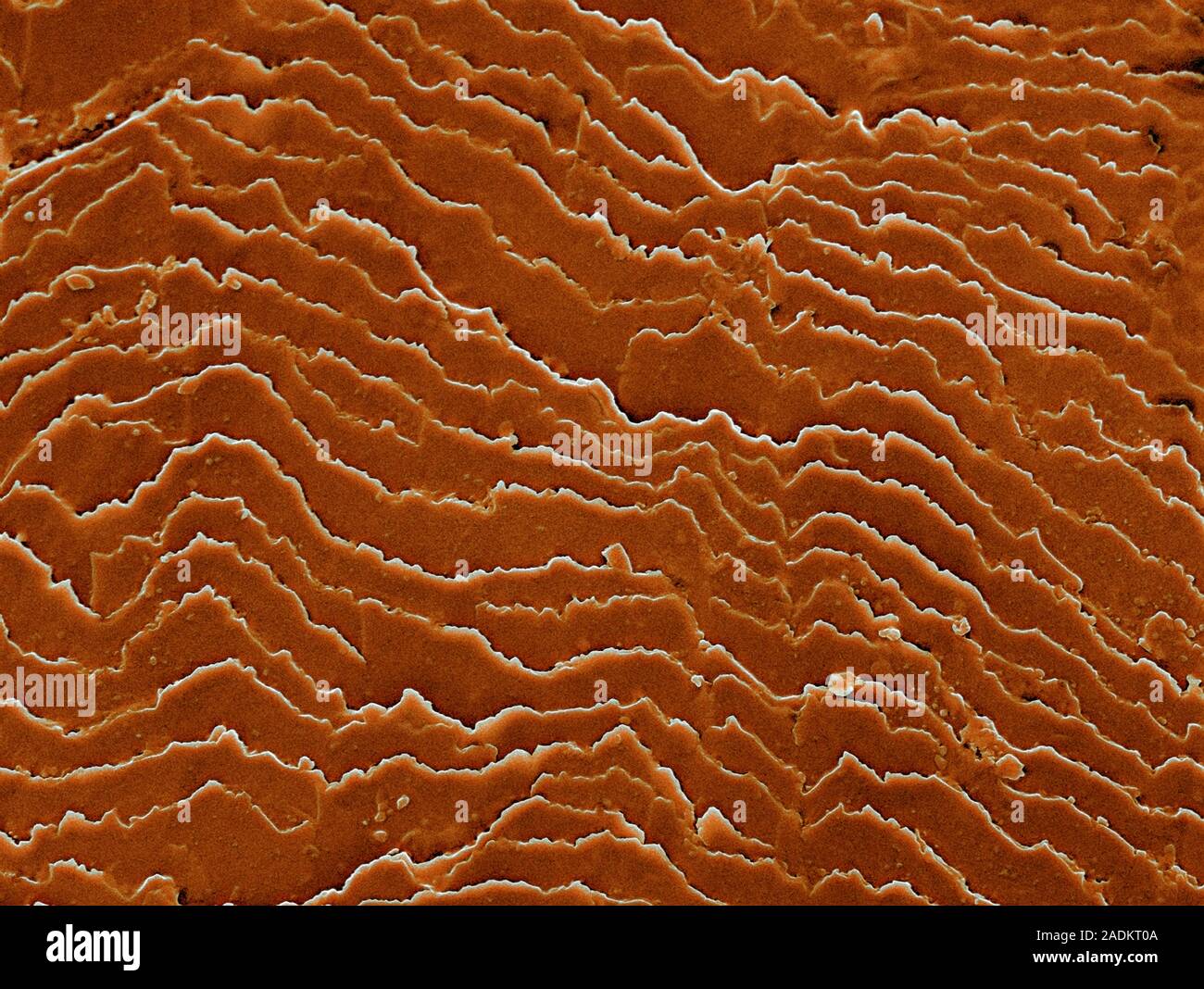 Cat's whisker. Coloured scanning electron micrograph (SEM) of a cat's ...