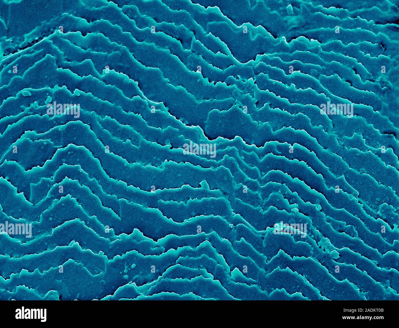 Cat's whisker. Coloured scanning electron micrograph (SEM) of a cat's ...