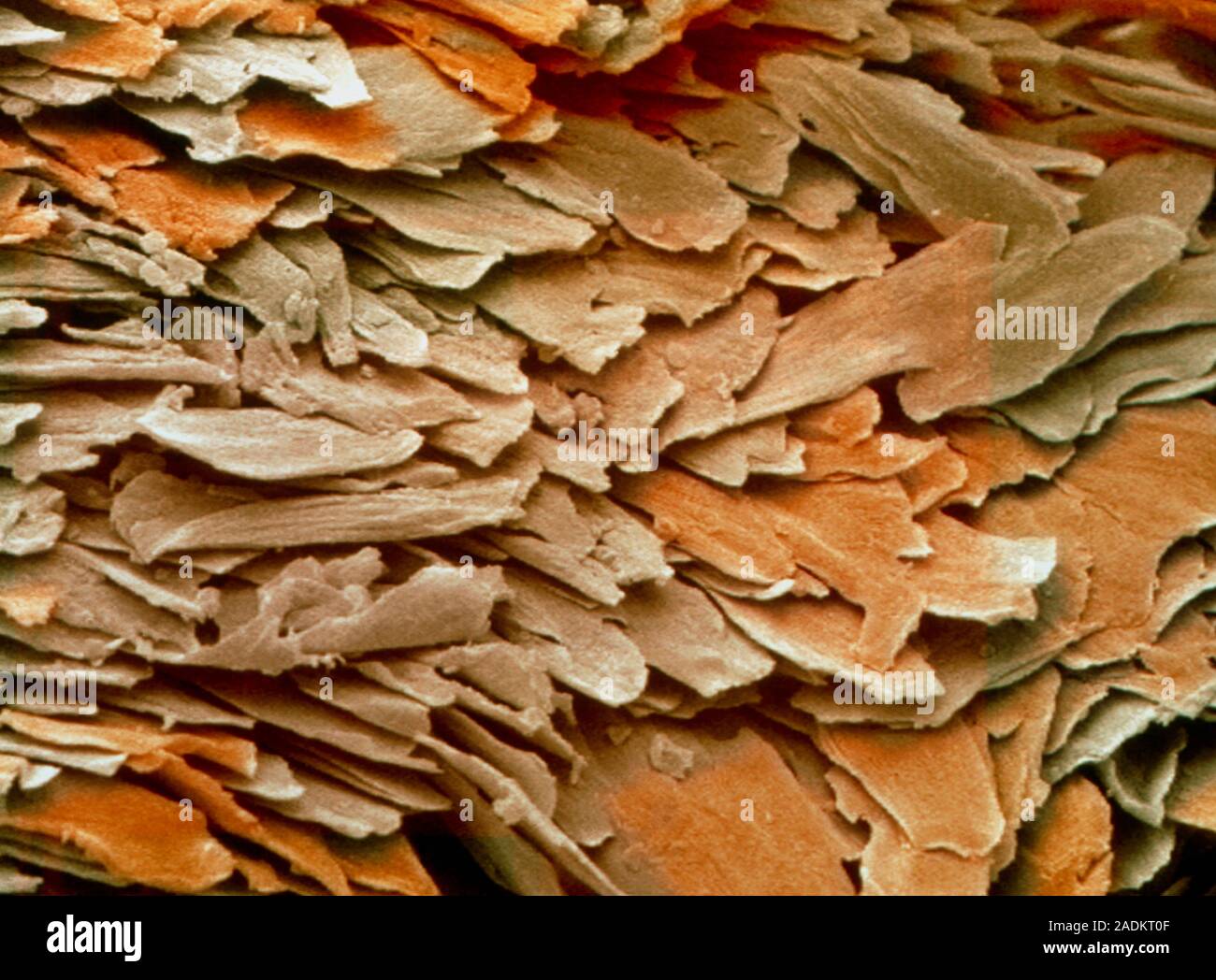 Fingernail. Coloured scanning electron micrograph (SEM) of a ...