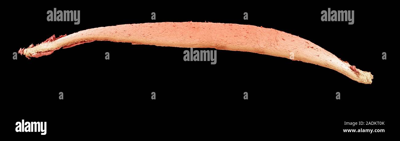 Nail clipping, coloured scanning electron micrograph (SEM Stock Photo ...