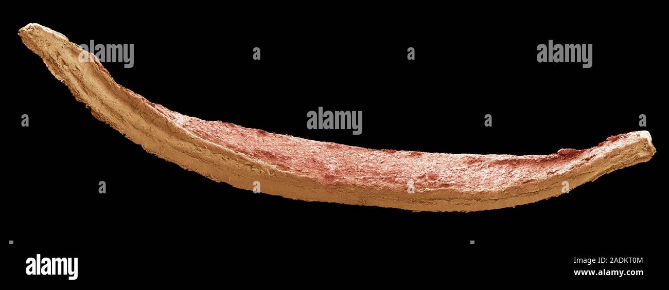 Nail clipping, coloured scanning electron micrograph (SEM Stock Photo ...