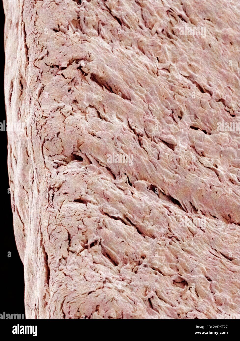 Nail edge. Coloured scanning electron micrograph (SEM) of the edge of a ...