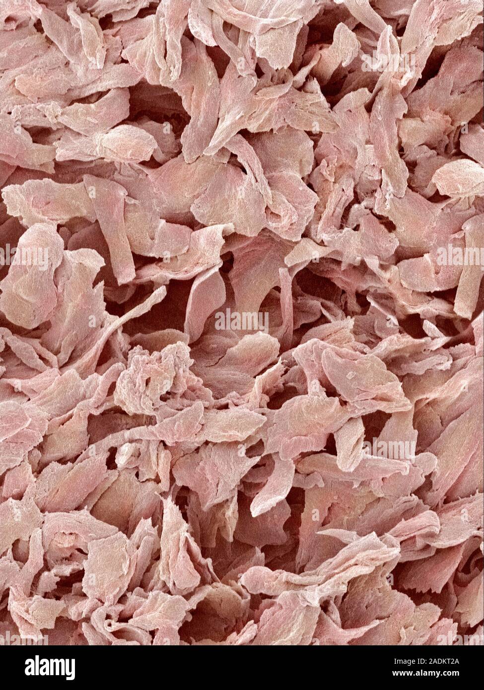 Nail flakes. Coloured scanning electron micrograph (SEM) of flakes of ...