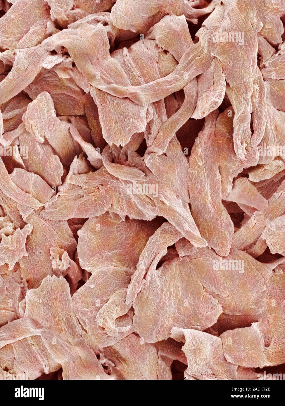 Nail flakes. Coloured scanning electron micrograph (SEM) of flakes of ...