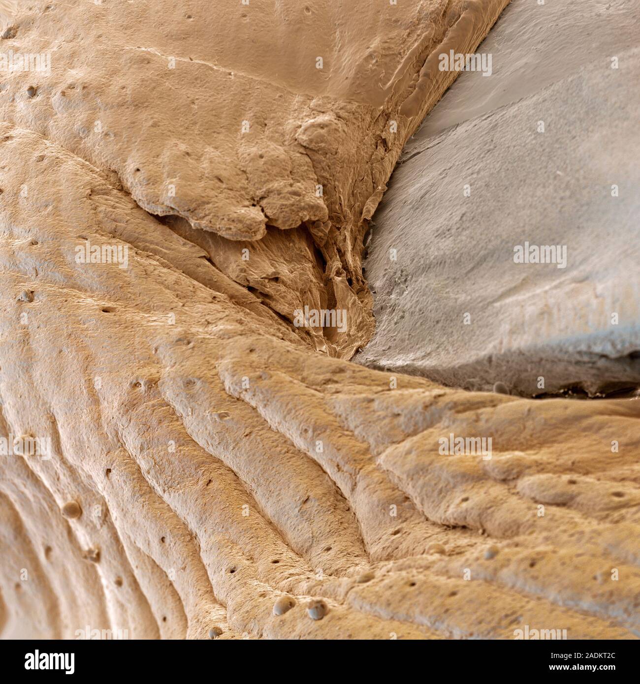 Nail base. Coloured scanning electron micrograph (SEM) of the base of a ...