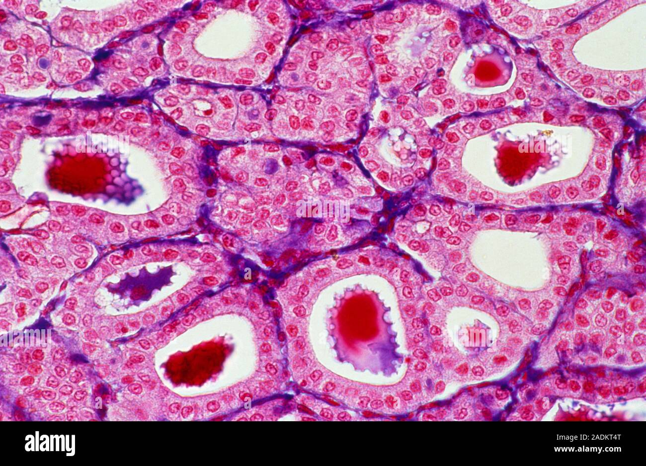 Light micrograph of the human thyroid gland, showing the functional ...