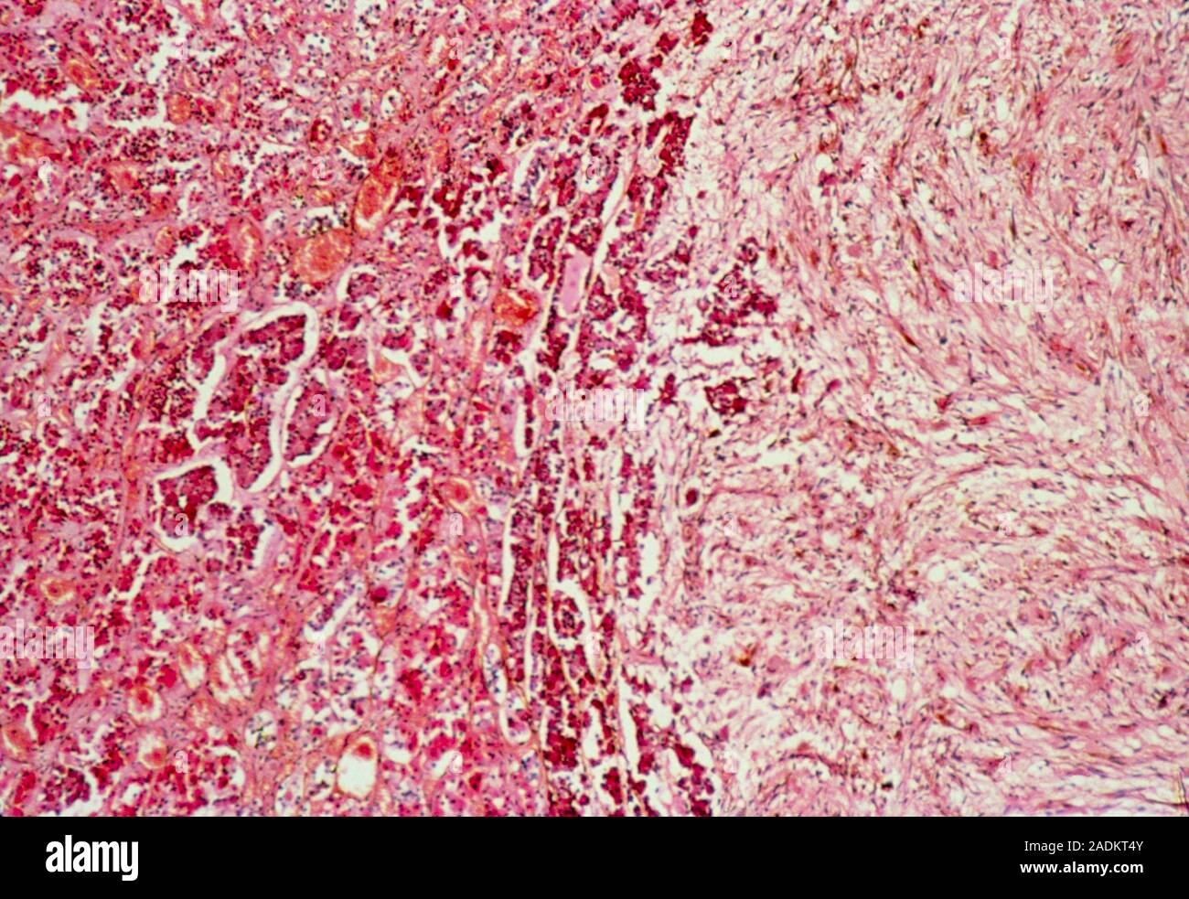 Light micrograph of normal human pituitary gland (hypophysis). The ...