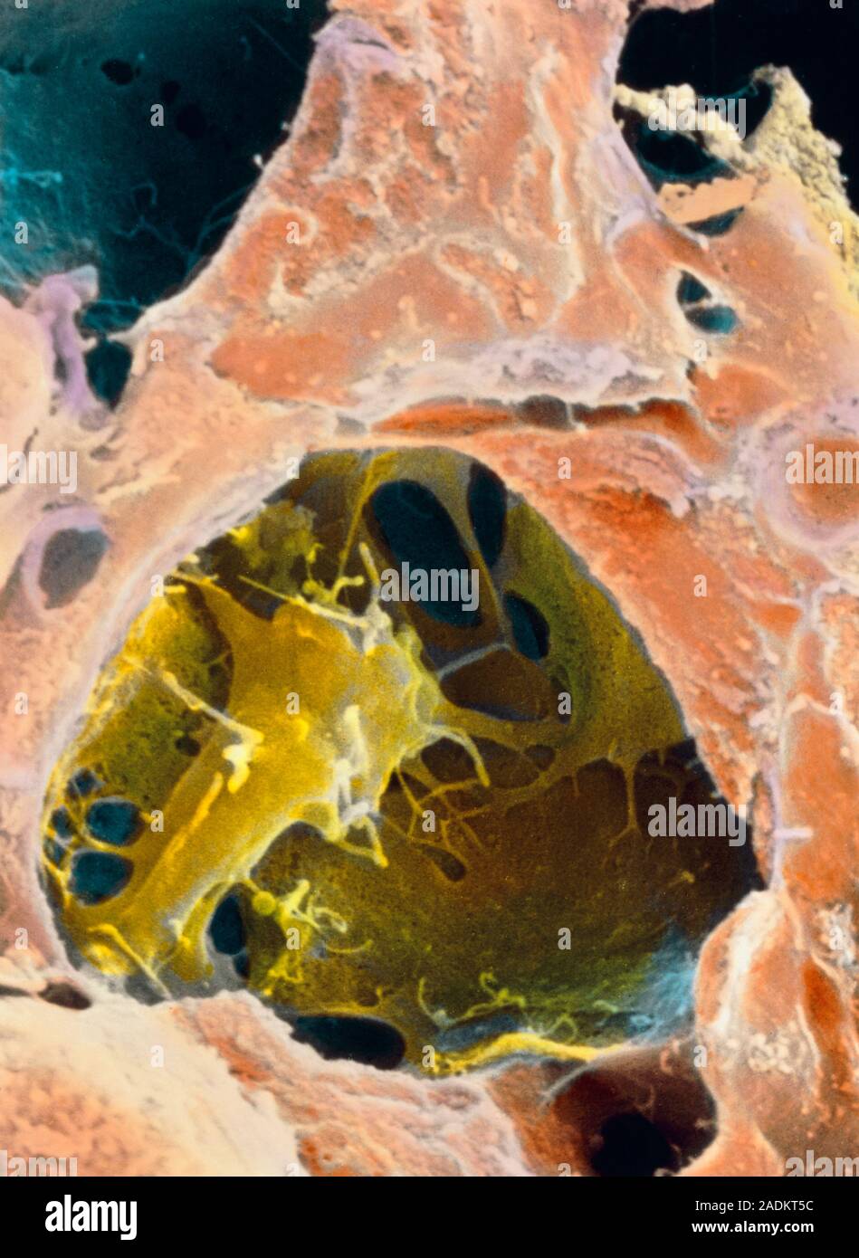 Pituitary gland. Coloured scanning electron micrograph of tissue of the ...