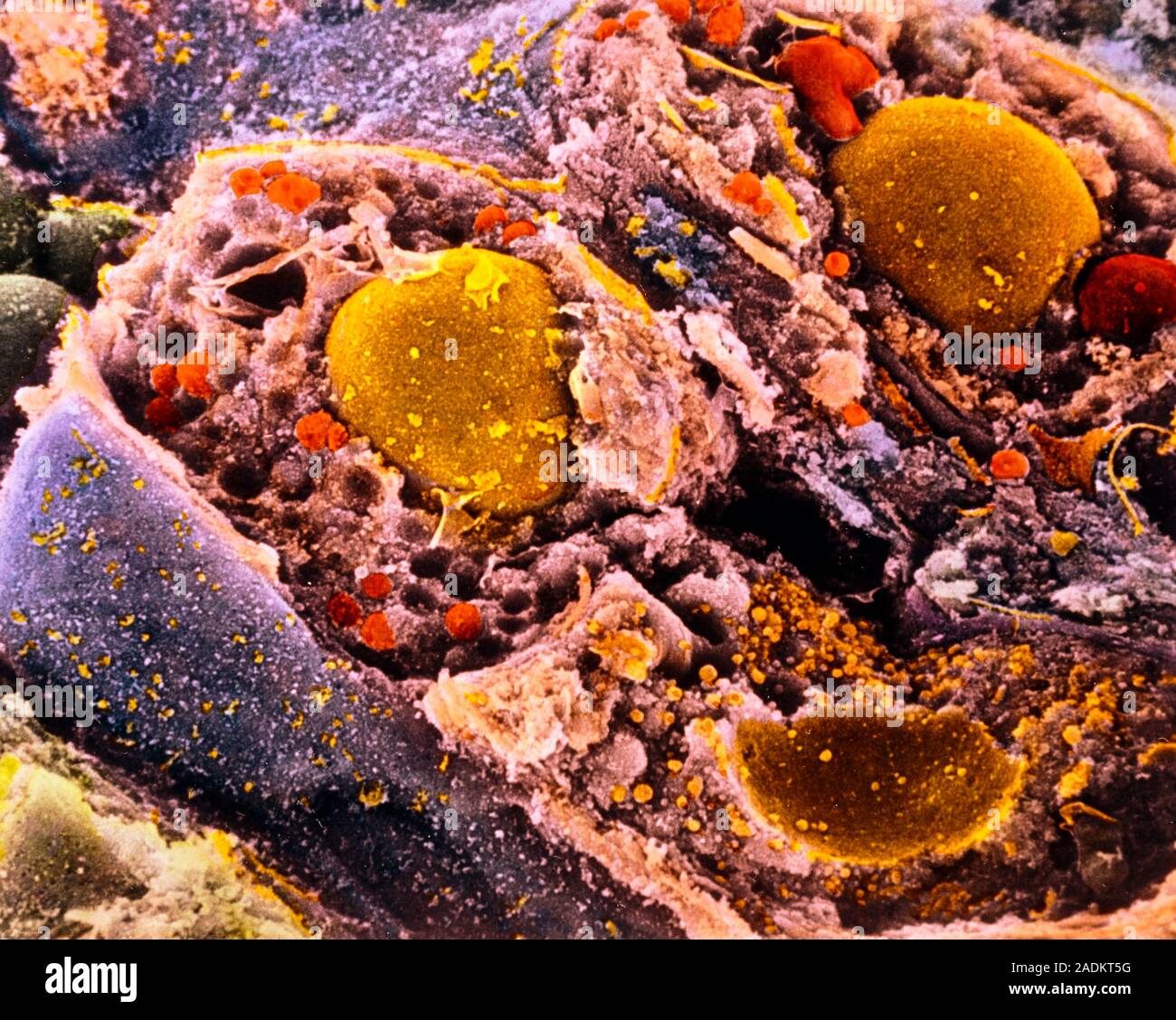 Adrenal gland cells. Coloured Scanning Electron Micrograph (SEM) of ...
