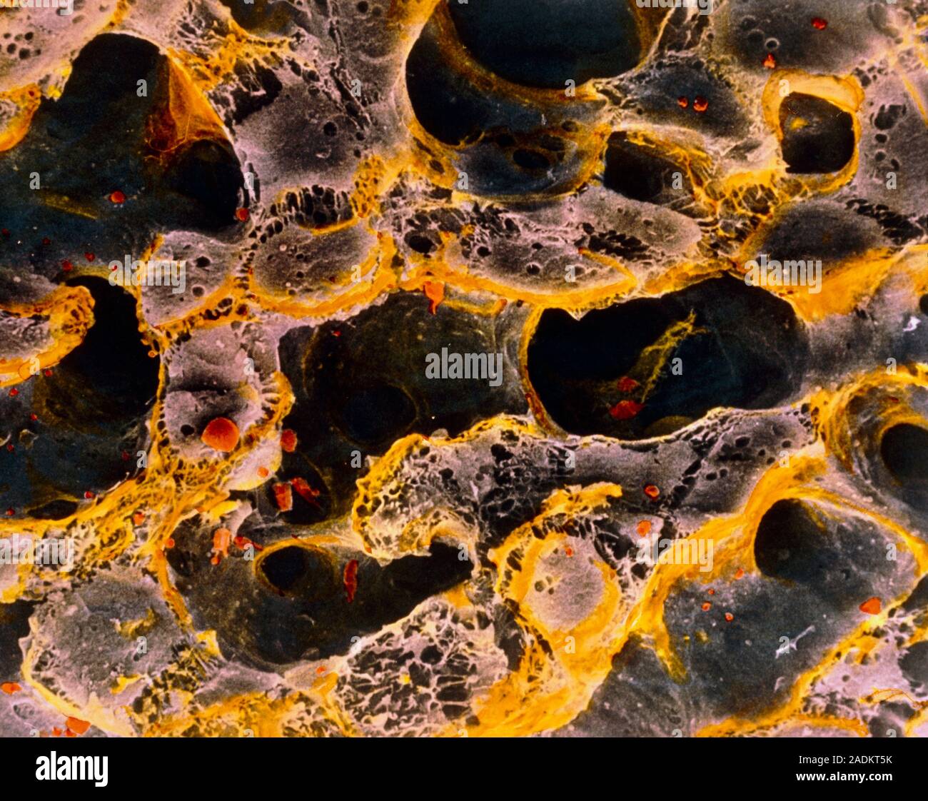 Adrenal gland. Coloured Scanning Electron Micrograph (SEM) of the ...