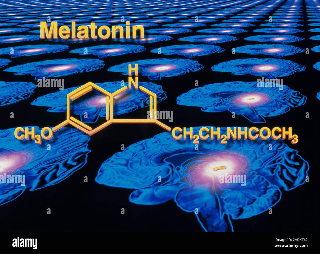 Melatonin and the pineal gland. Computer artwork of sectioned human ...