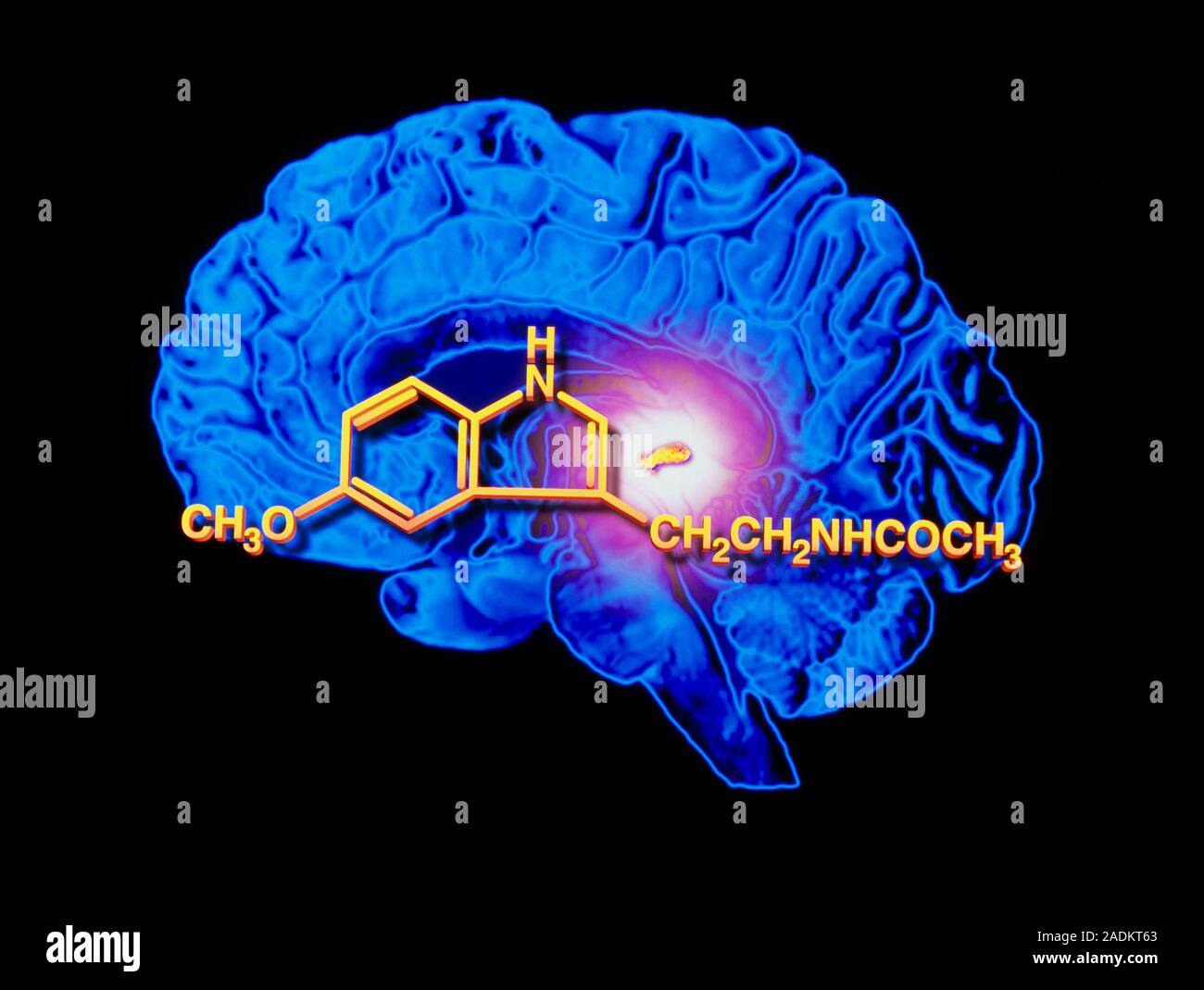 Melatonin and the pineal gland. Computer artwork of a sectioned human ...
