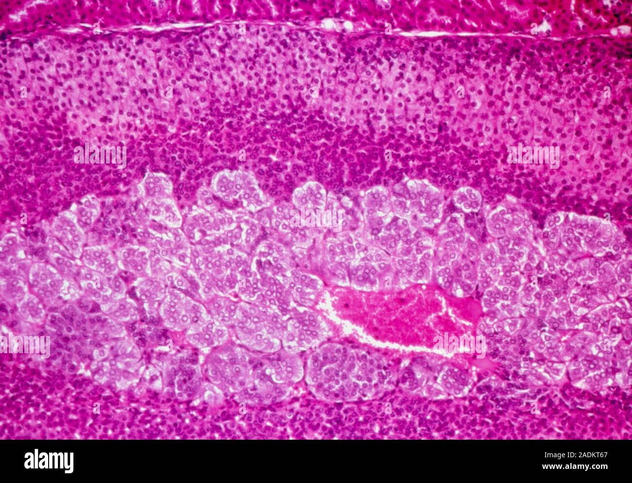Adrenal gland. Light micrograph of a cross section through an adrenal ...
