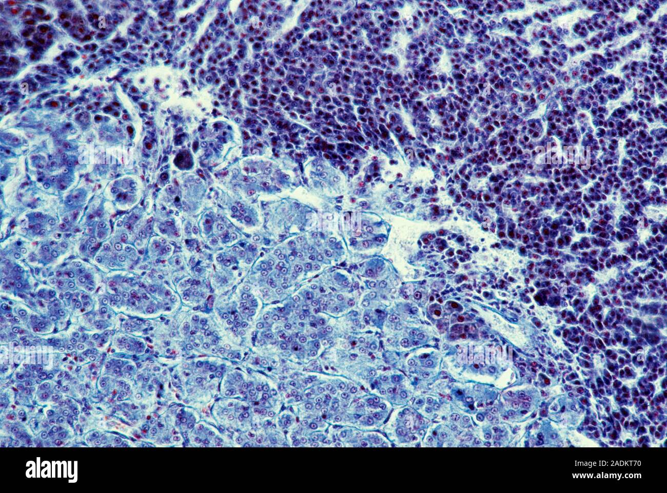 Adrenal gland. Light micrograph of a section through the adrenal gland ...