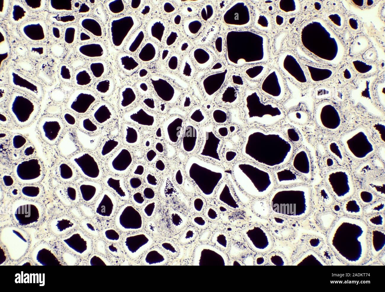 Thyroid gland. Coloured light micrograph (LM) of a human thyroid gland ...