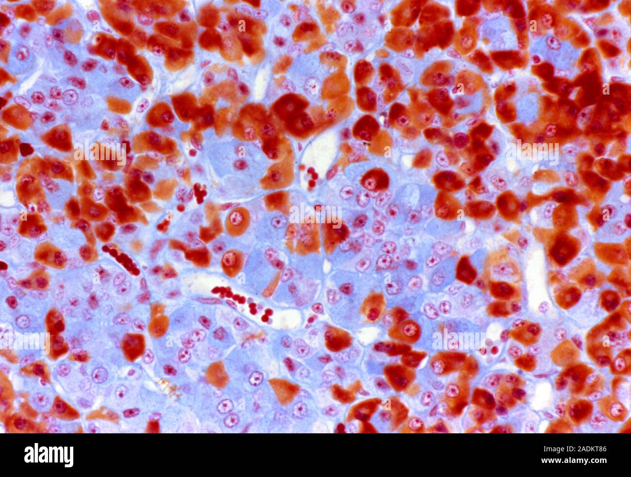 Pituitary gland tissue. Light micrograph of a section through the pars ...