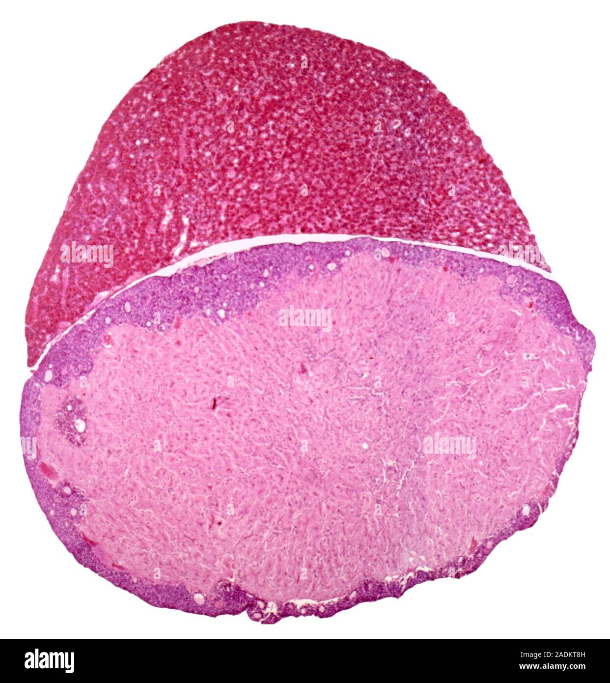 Pituitary gland. Light micrograph of a section through the pituitary ...