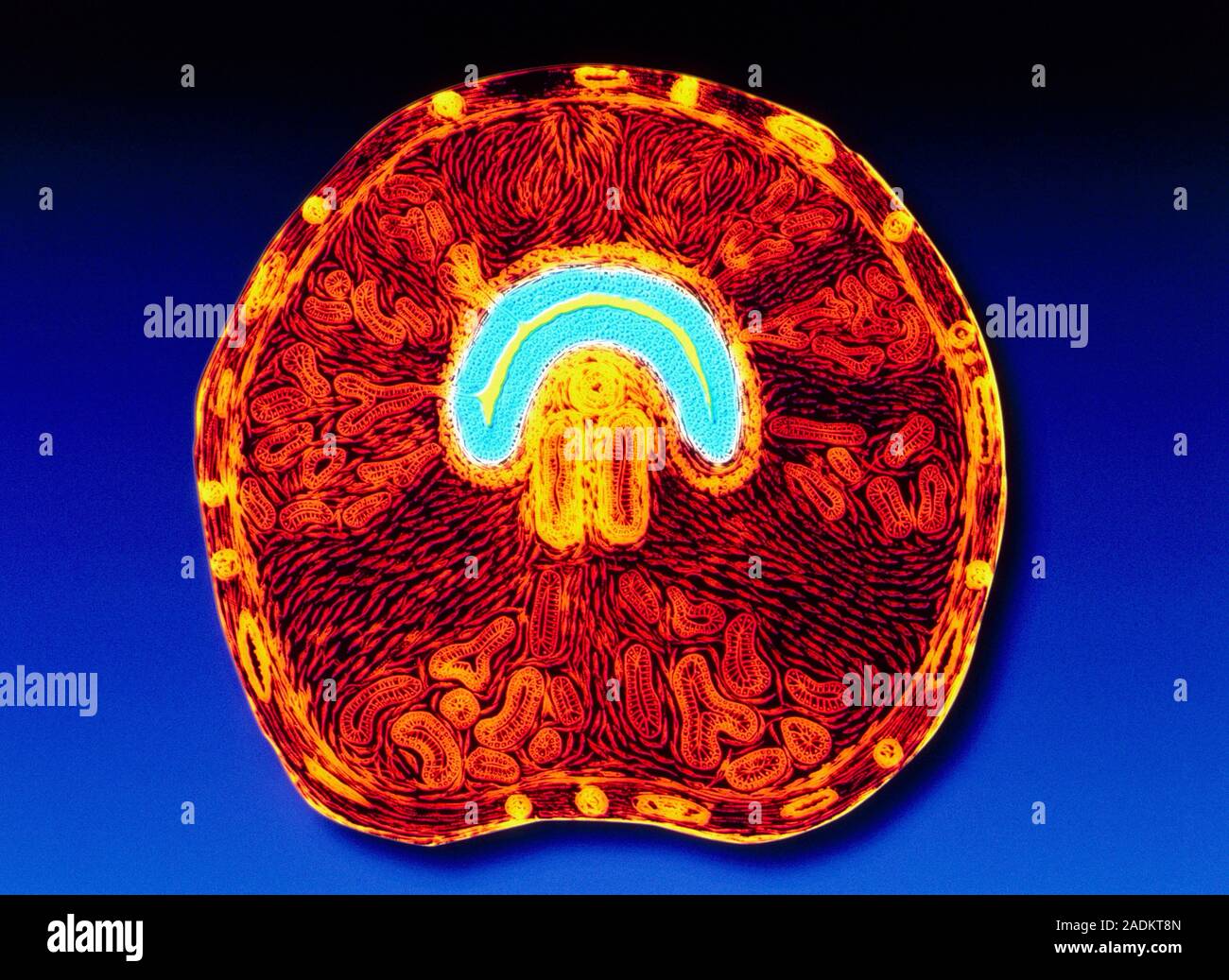 Prostate gland. Computer artwork of a section through the human ...