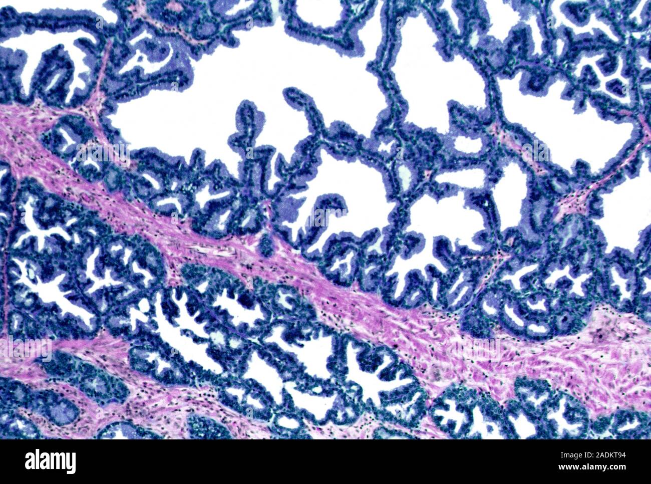 Prostate gland. Coloured light micrograph of a section through a ...