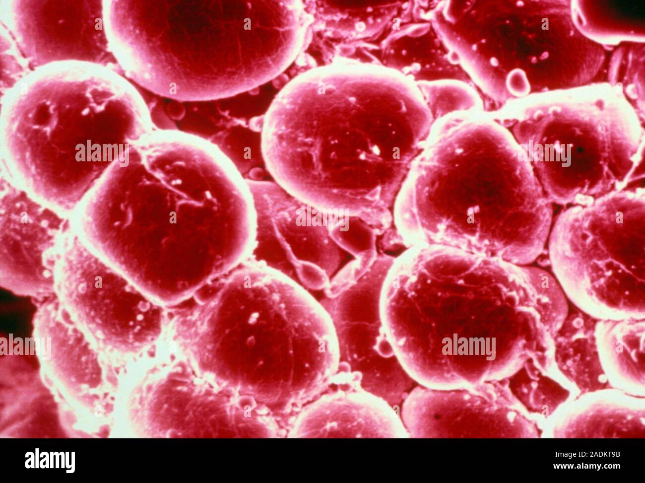 Fat cells. False-colour scanning electron micrograph of human fat cells ...