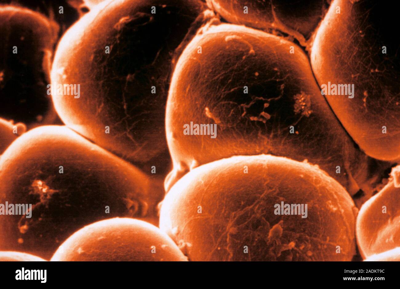 Fat cells. False-colour scanning electron micrograph of human fat cells ...