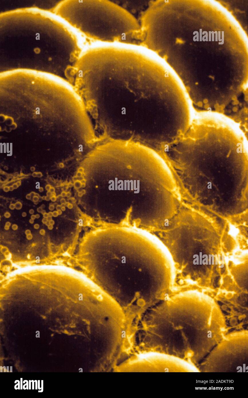 Fat cells. Coloured scanning electron micrograph (SEM) of a group of ...