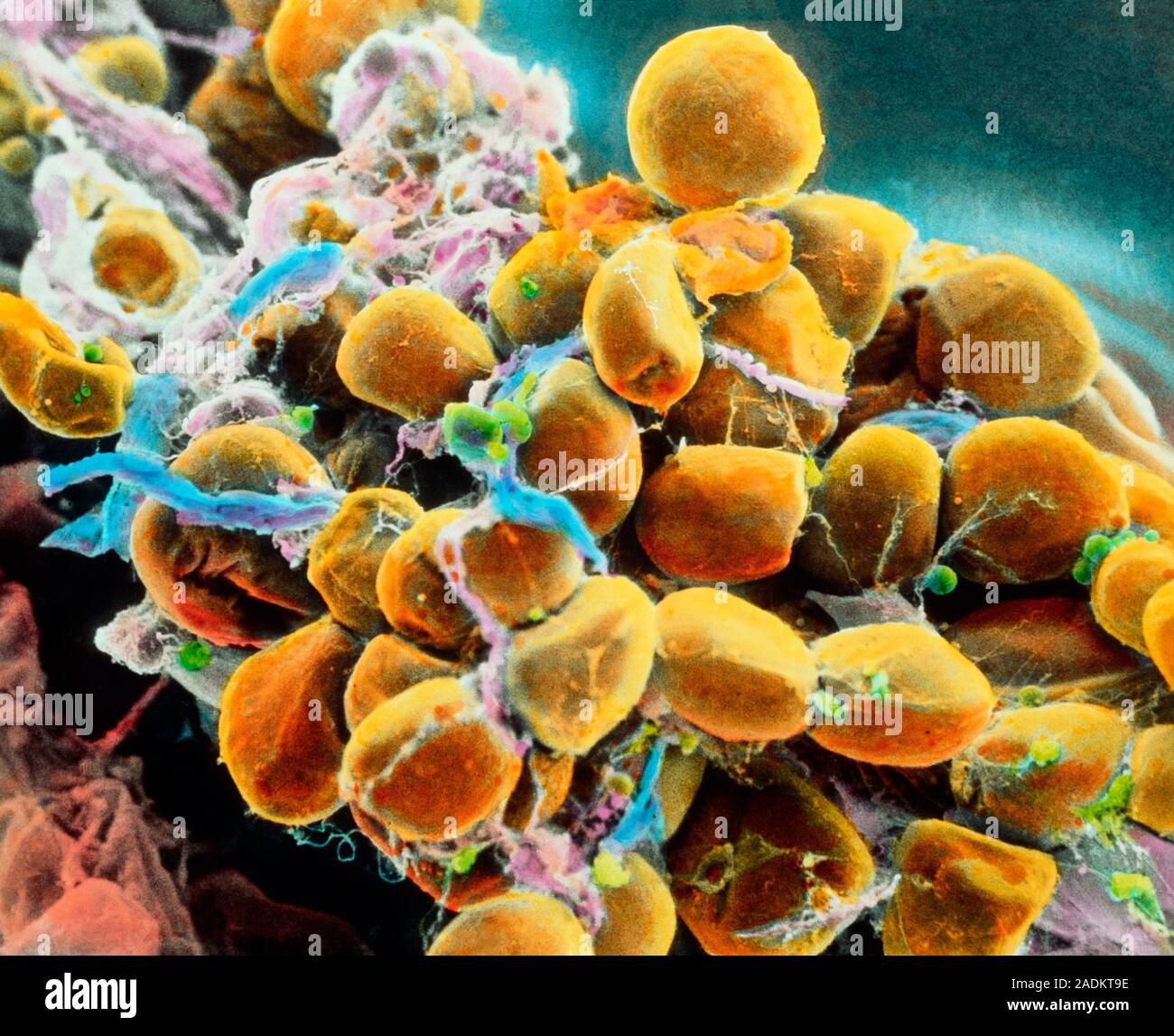 Adipose tissue. Coloured scanning electron micrograph of fat-storing ...