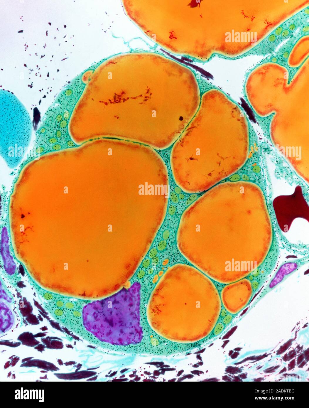 Fat Cell Coloured Transmission Electron Micrograph Tem Of A Section Through A Fat Cell