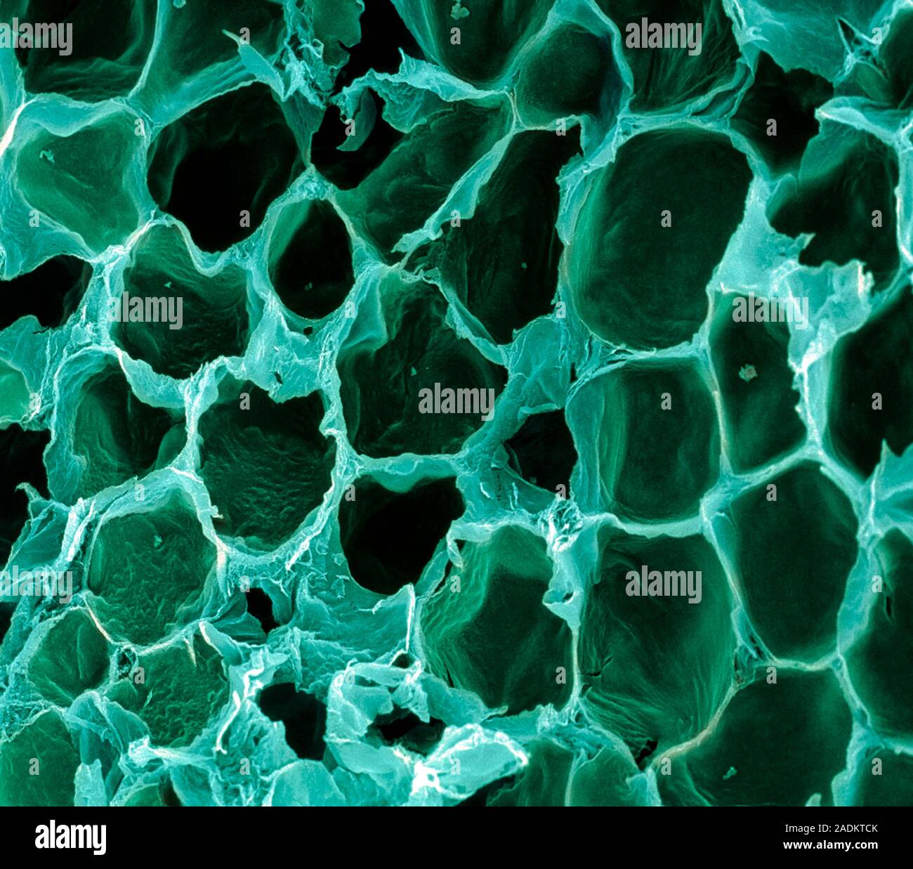 Empty fat cells. Coloured scanning electron micrograph (SEM) of the ...