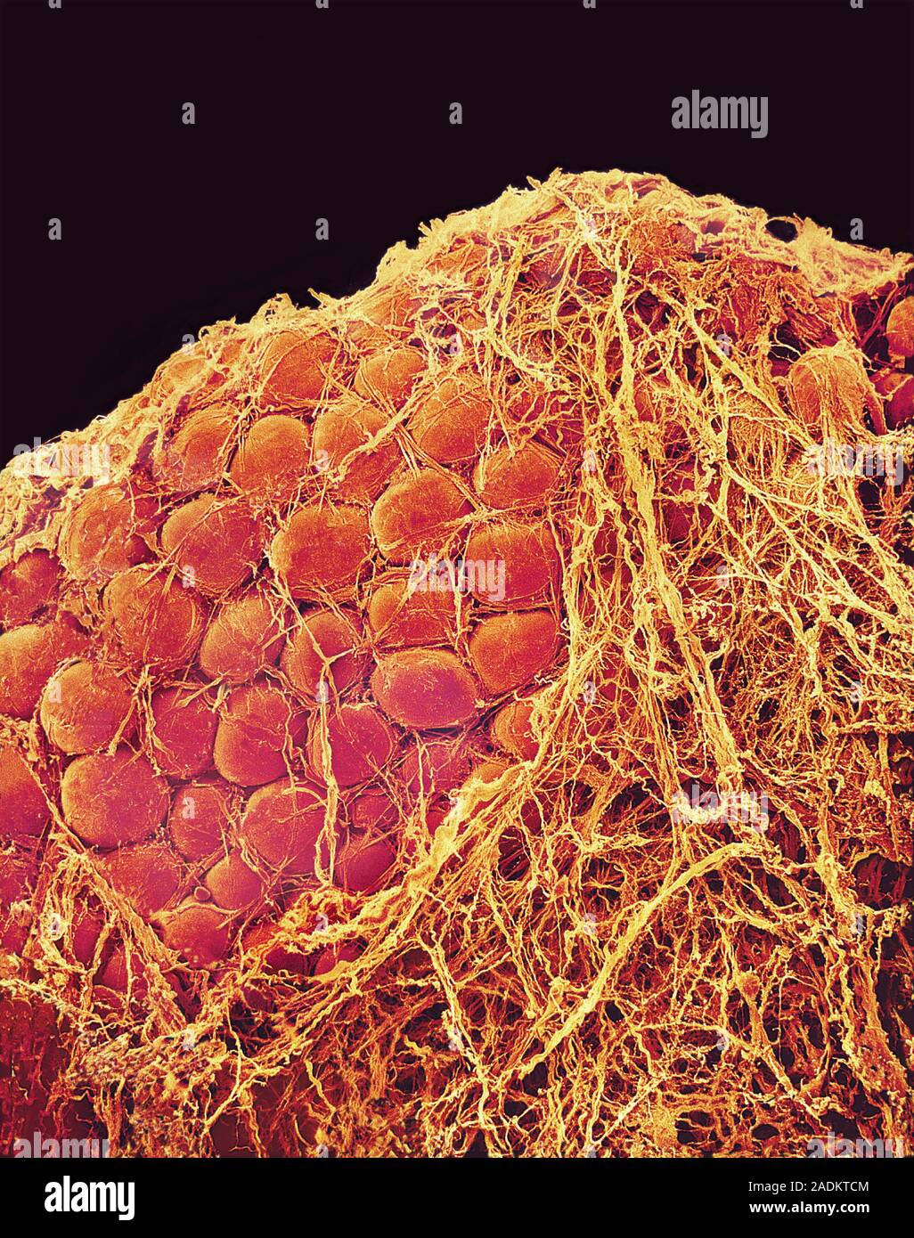 Fat cells. Coloured scanning electron micrograph (SEM) of fat cells ...