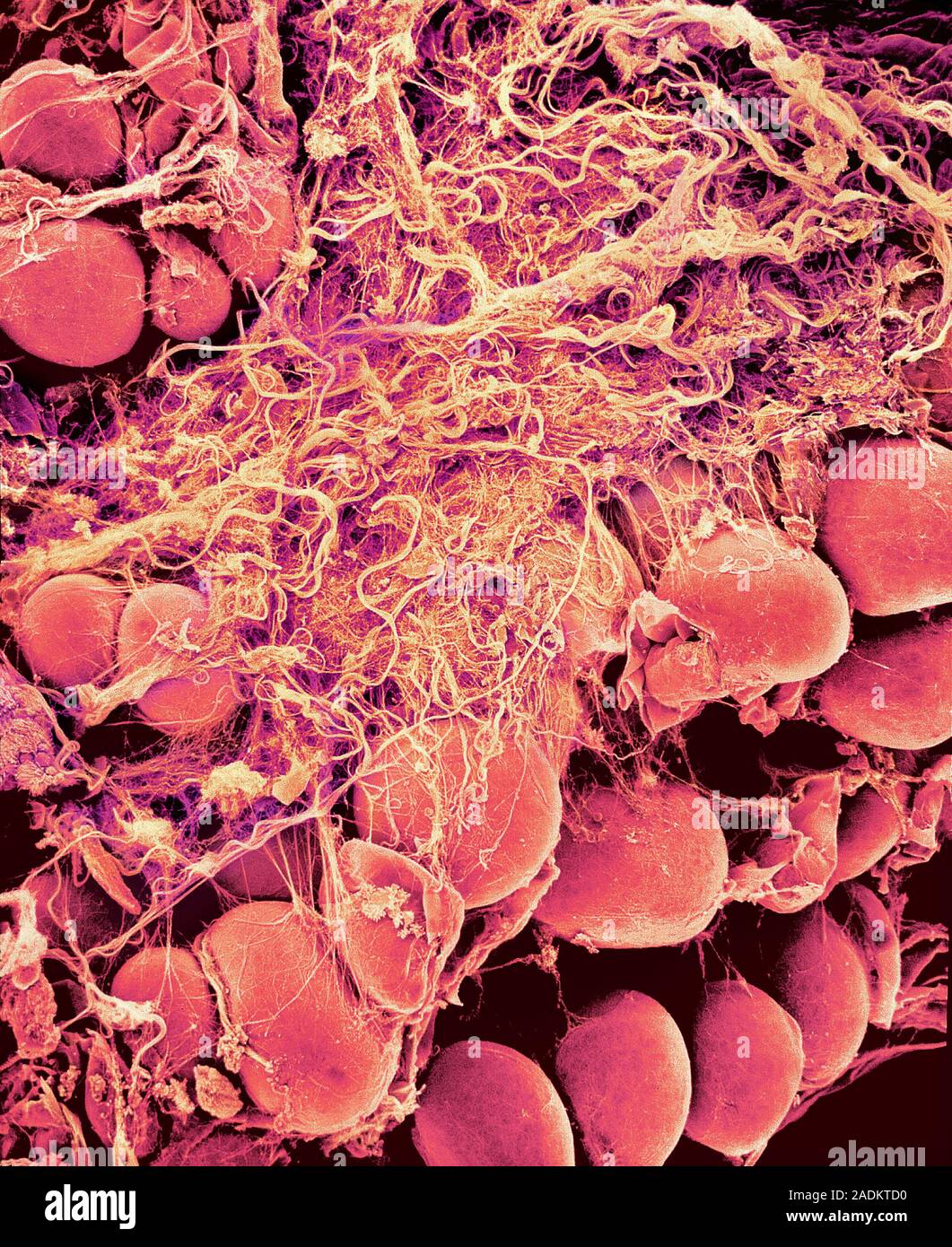 Fat Tissue Coloured Scanning Electron Micrograph Sem Of Adipose Tissue Consisting Of Fat