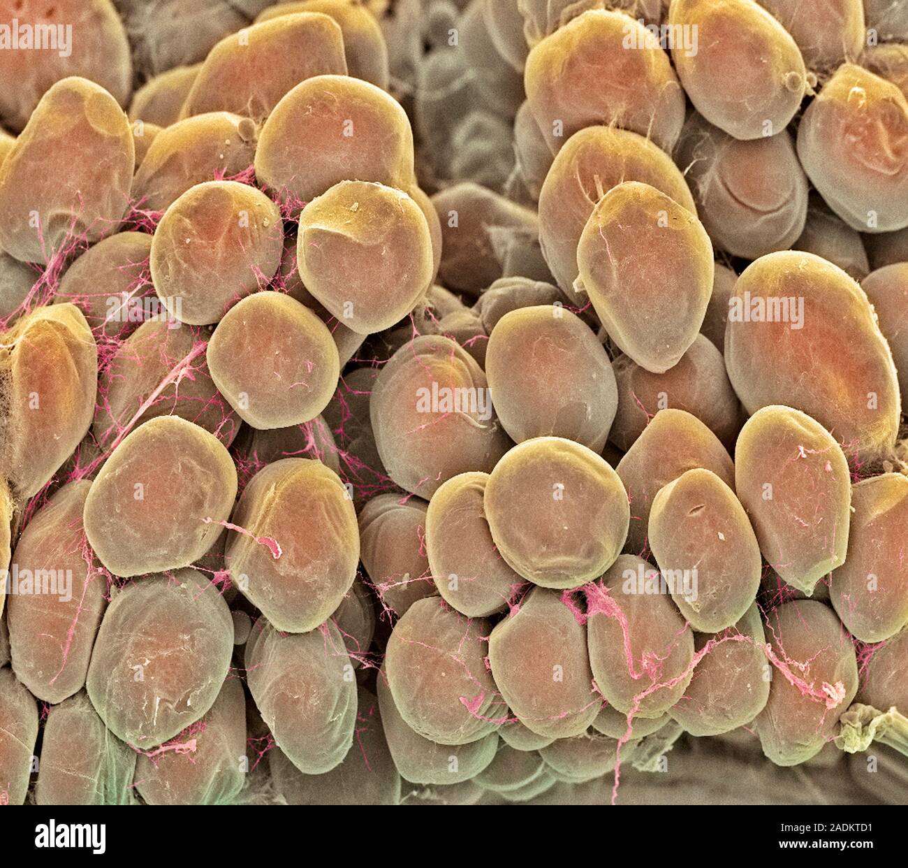 Fat tissue. Coloured scanning electron micrograph (SEM) of adipose ...