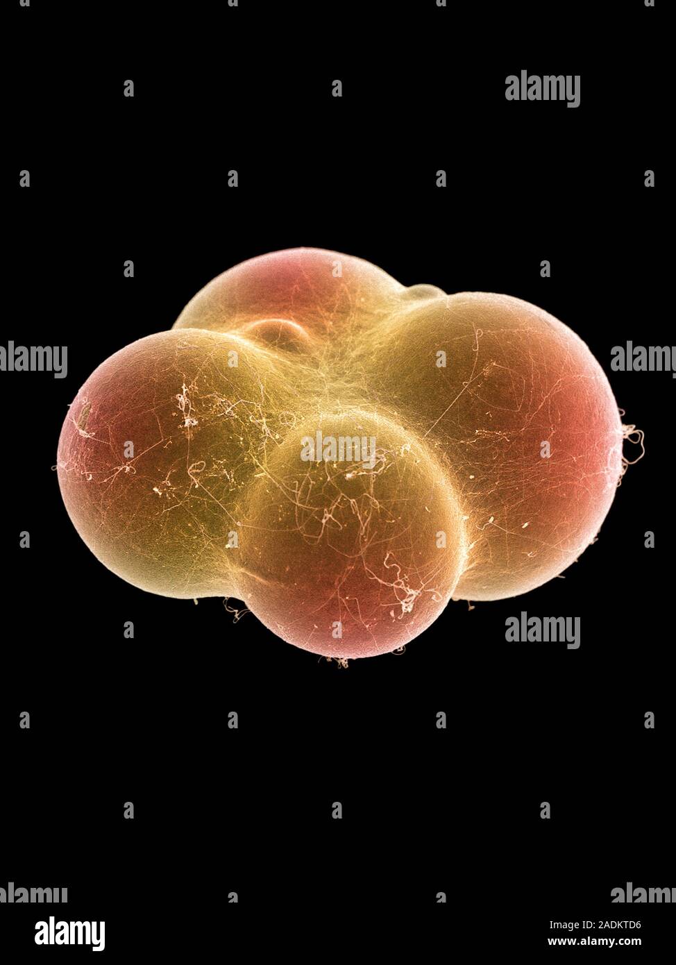 Fat cells. Coloured scanning electron micrograph (SEM) of four joined ...
