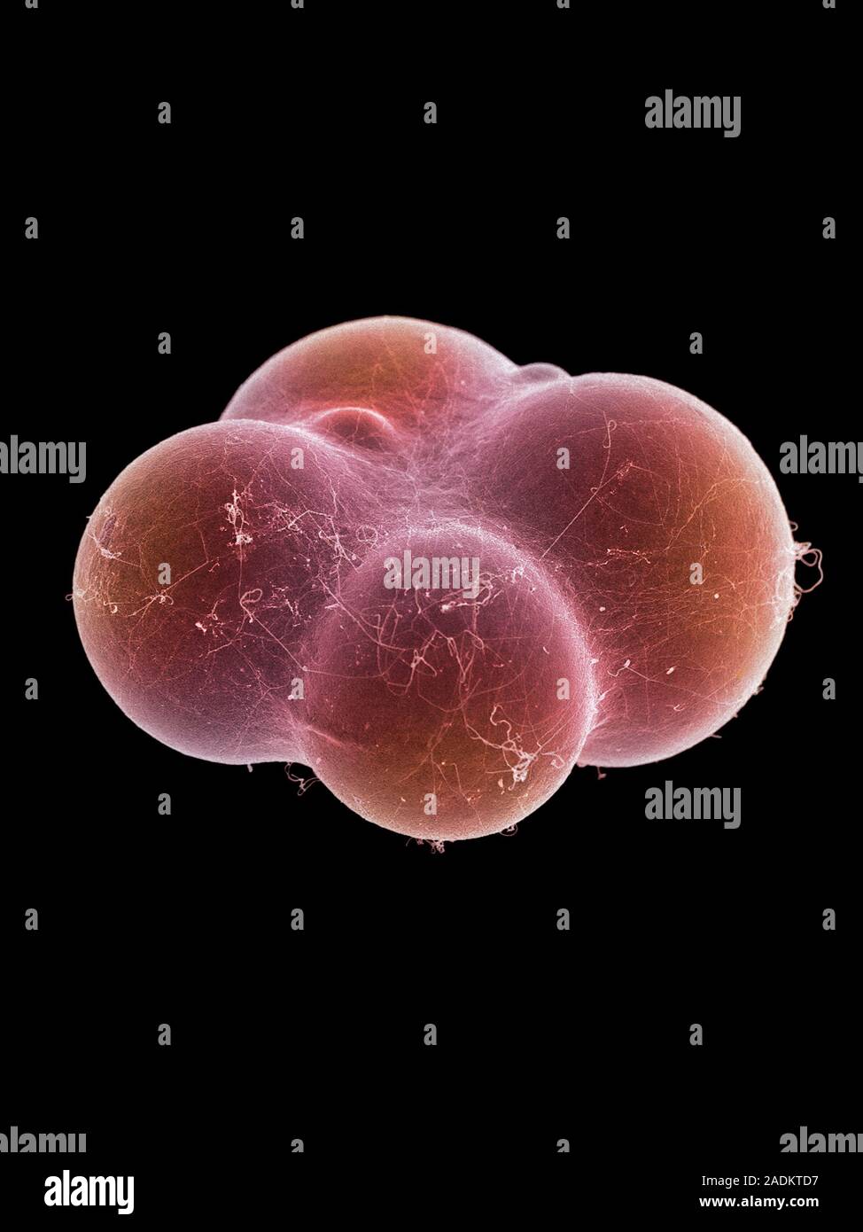 Fat cells. Coloured scanning electron micrograph (SEM) of four joined ...