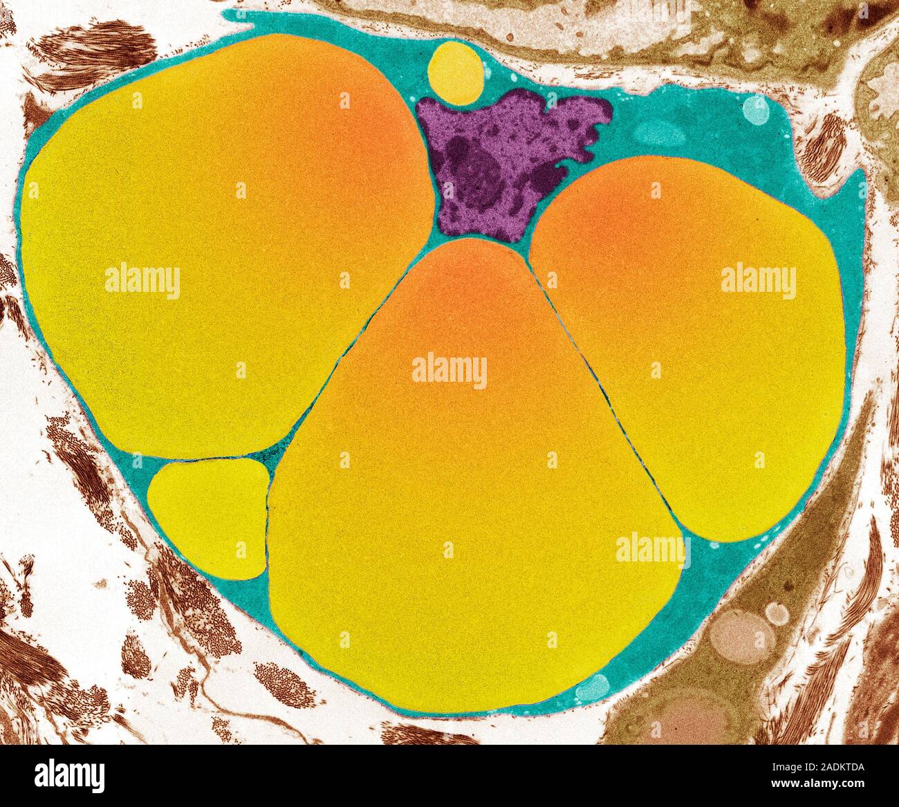 Fat cell. Coloured transmission electron micrograph (TEM) of lipid ...