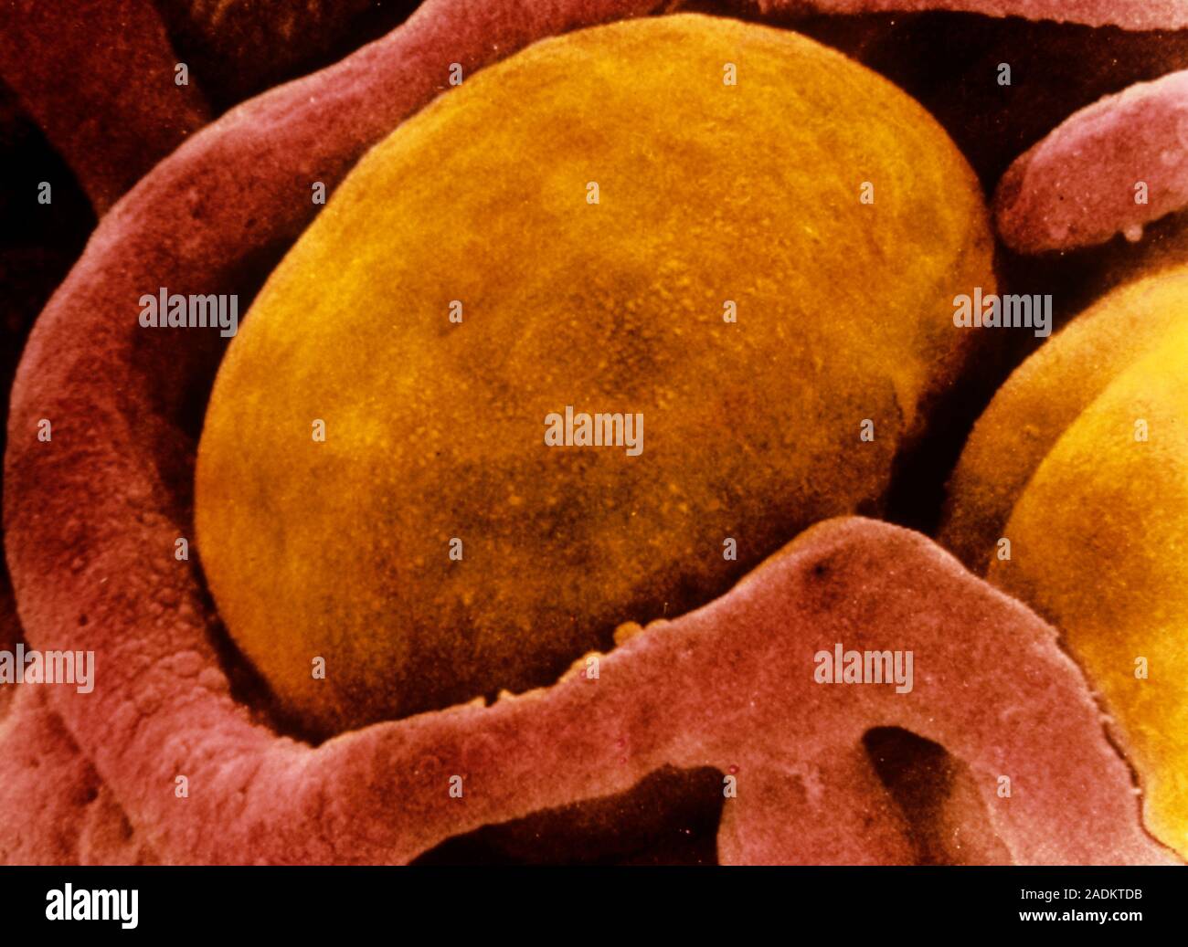 Fat cell. Coloured scanning electron micrograph (SEM) of a brown fat ...