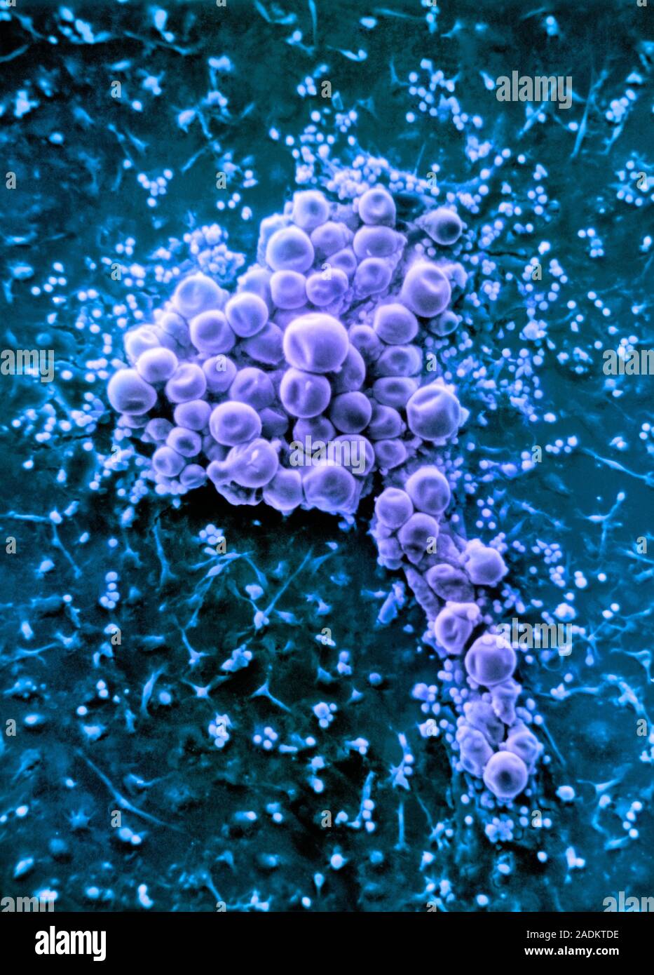 Fat cells. Coloured scanning electron micrograph (SEM) of adipocytes ...