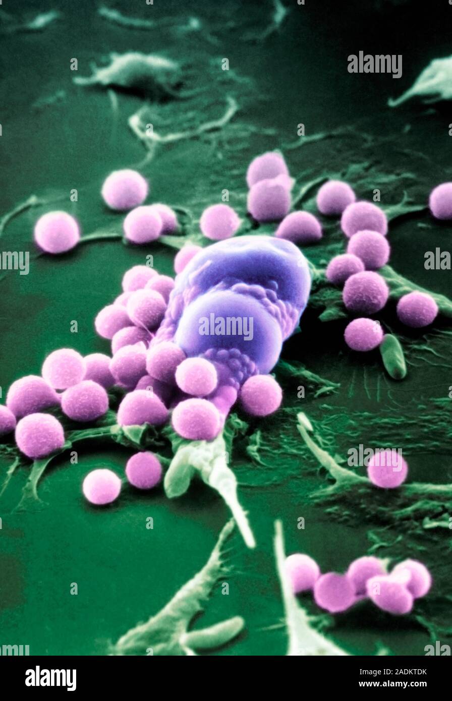 Fat cells. Coloured scanning electron micrograph (SEM) of adipocytes ...