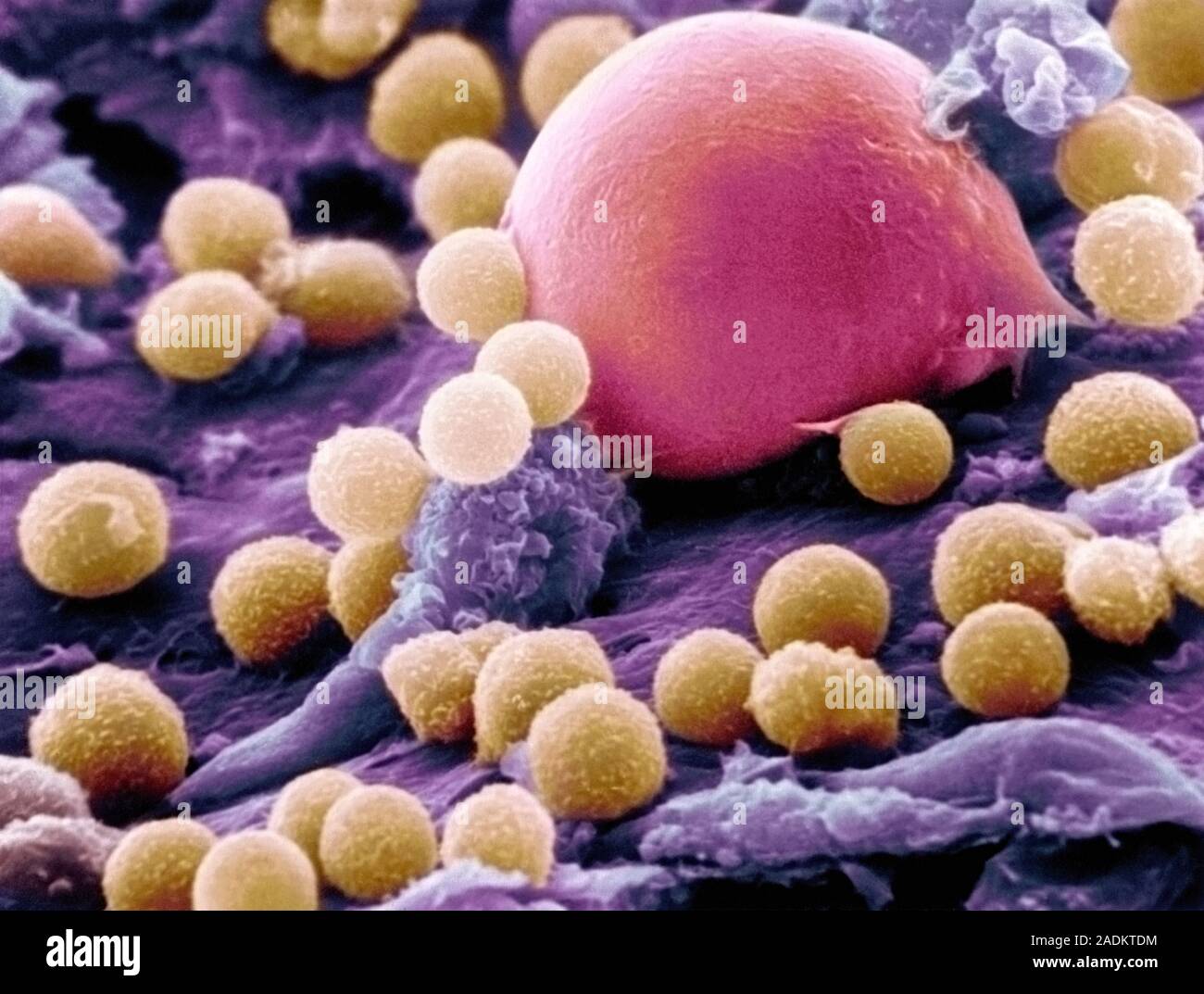 Fat cell. Coloured scanning electron micrograph (SEM) of an adipocyte ...