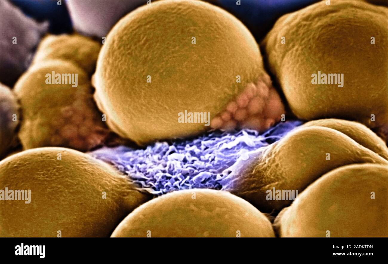Fat cells. Coloured scanning electron micrograph (SEM) of adipocytes ...