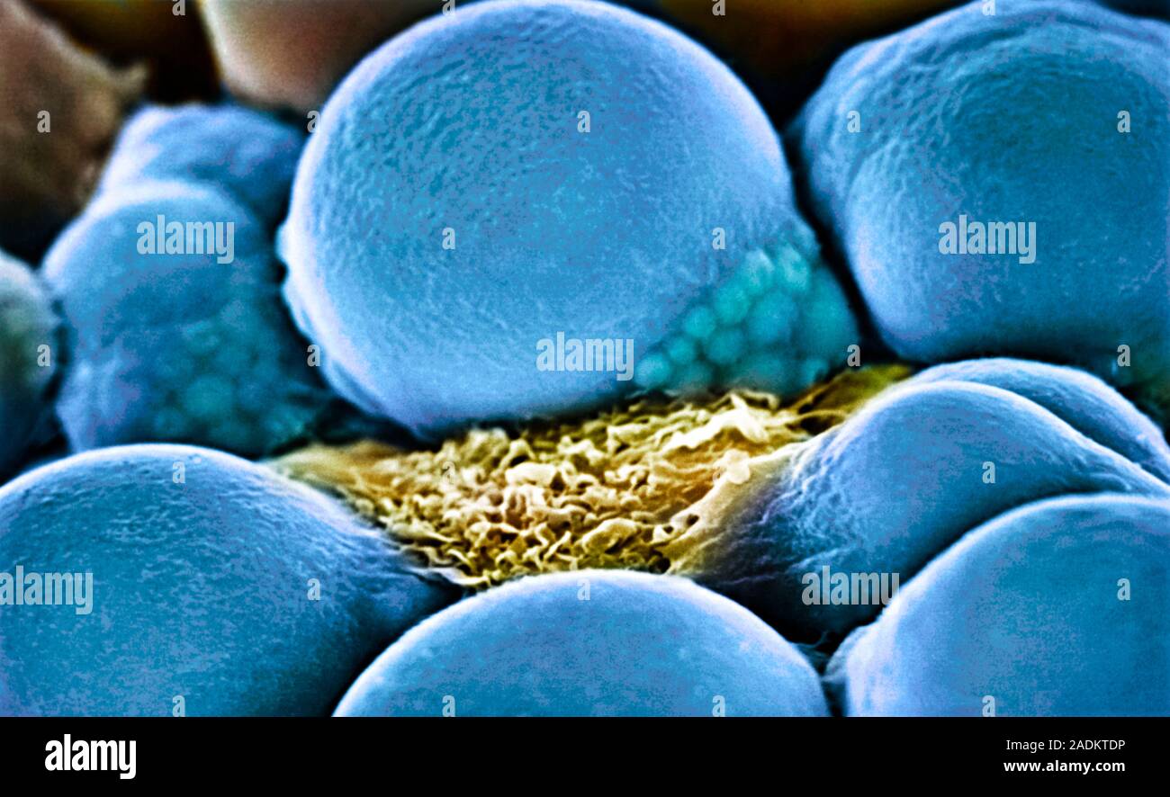 Fat cells. Coloured scanning electron micrograph (SEM) of adipocytes ...
