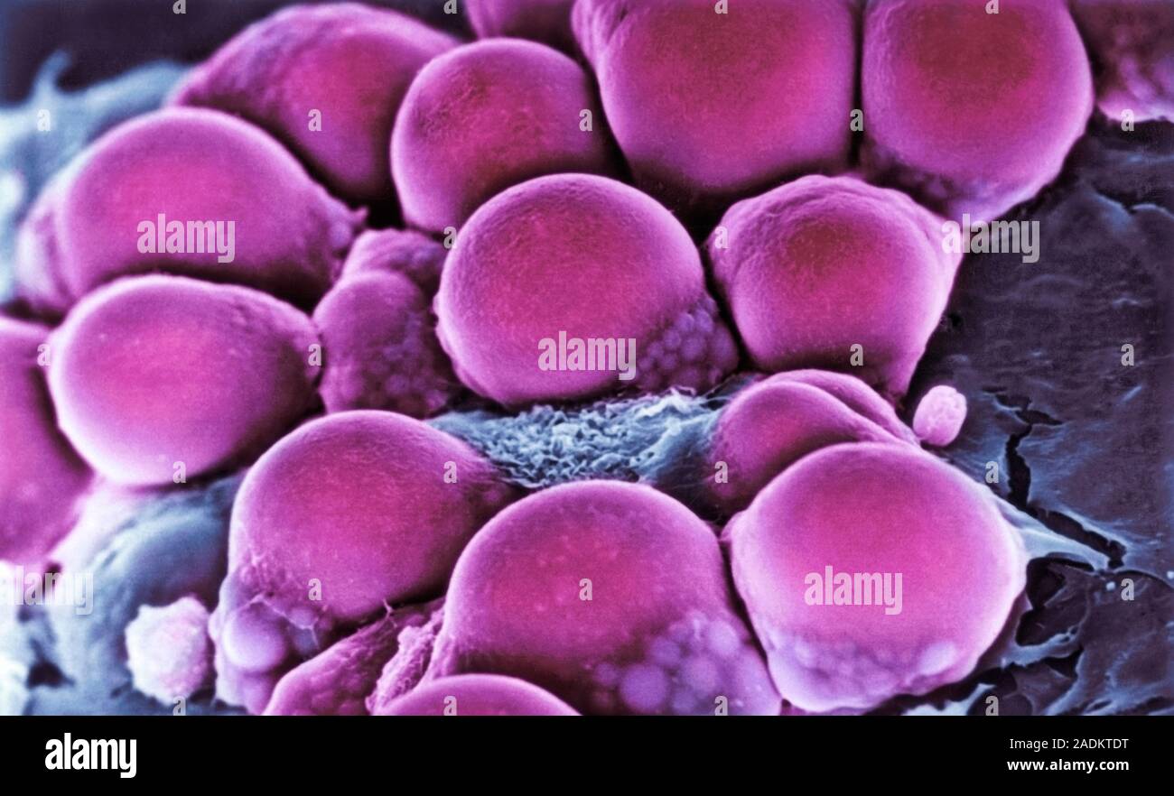 Fat cells. Coloured scanning electron micrograph (SEM) of adipocytes ...