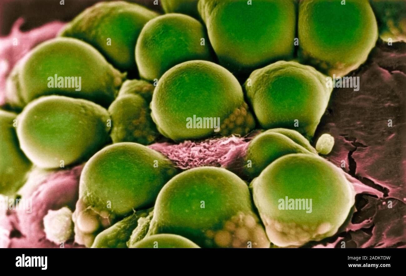Fat cells. Coloured scanning electron micrograph (SEM) of adipocytes ...