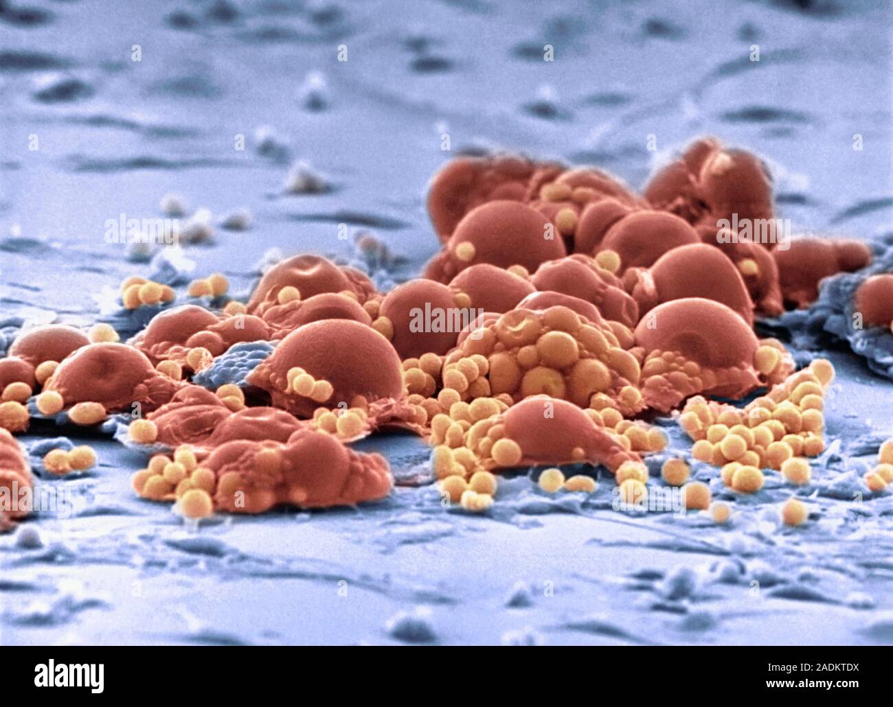 Fat cells. Coloured scanning electron micrograph (SEM) of adipocytes ...