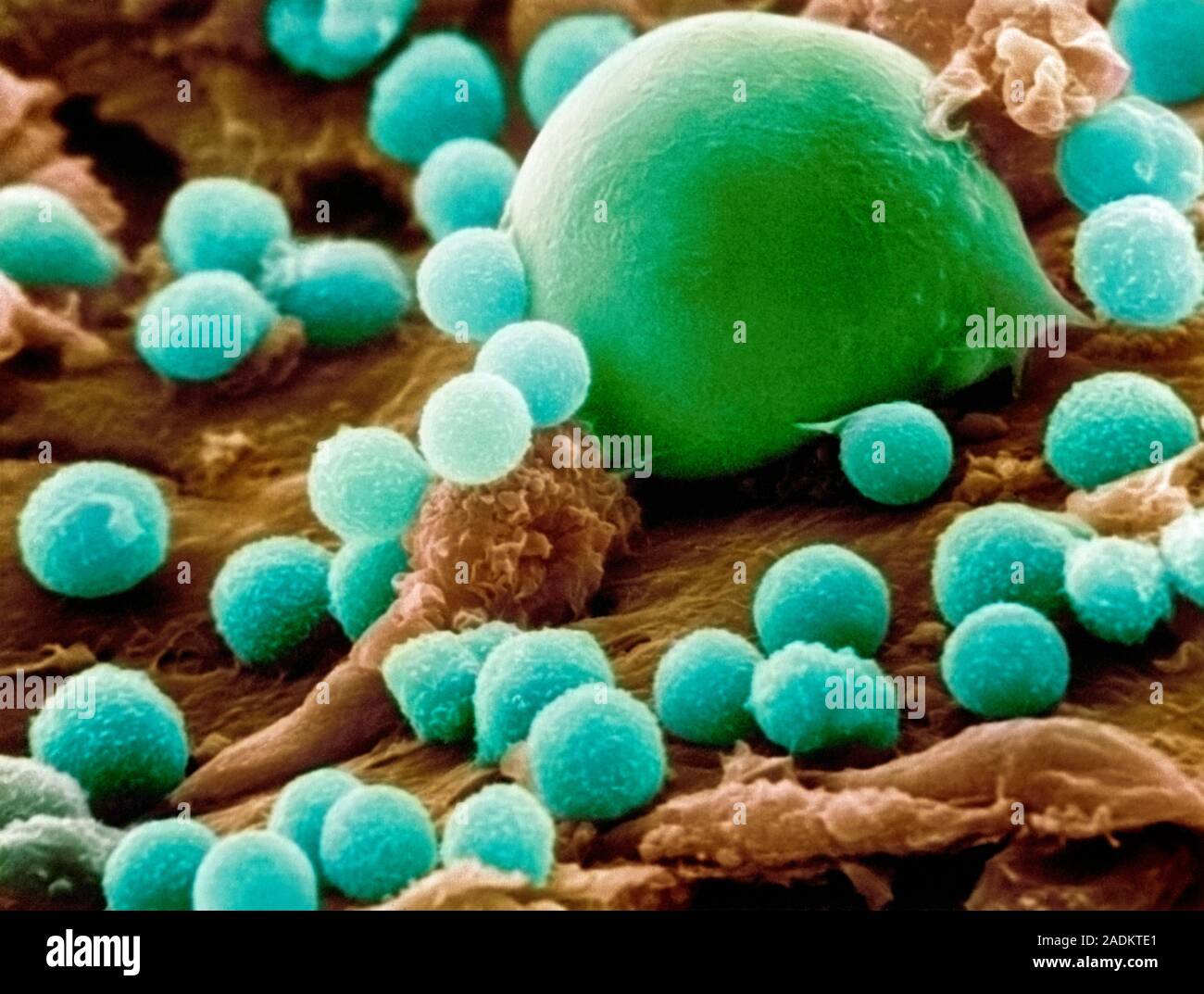 Fat cell. Coloured scanning electron micrograph (SEM) of an adipocyte ...